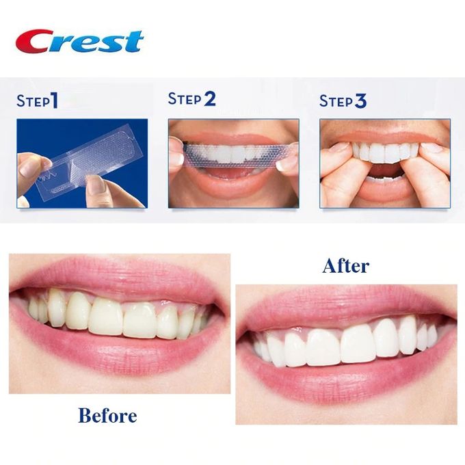 Crest 3D Whitestrips GLAMOROUS WHITE 14 bandes= 7 Sachets , 7 ...